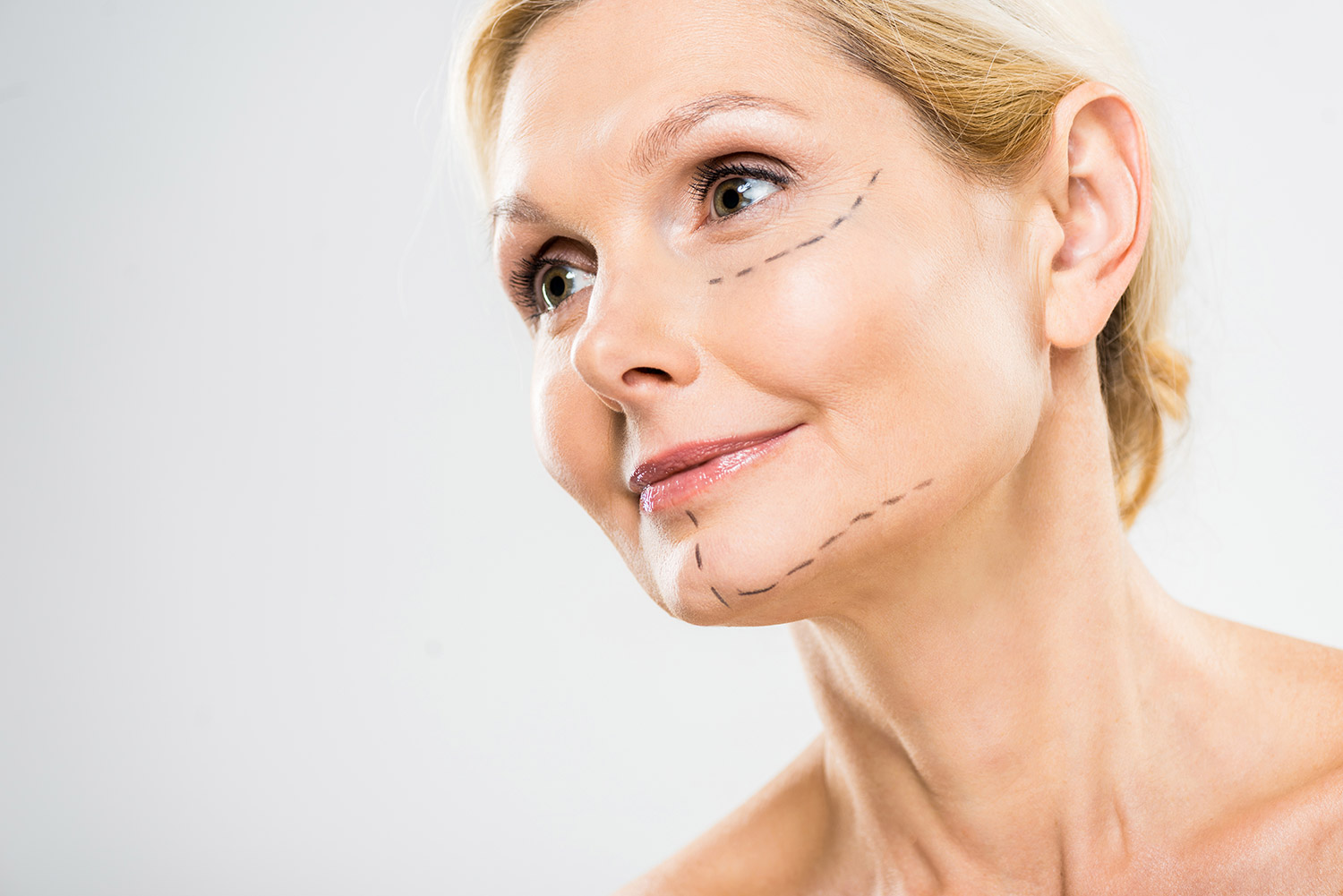 Scars from facelift surgery: what you need to know - Dr Patricia ...